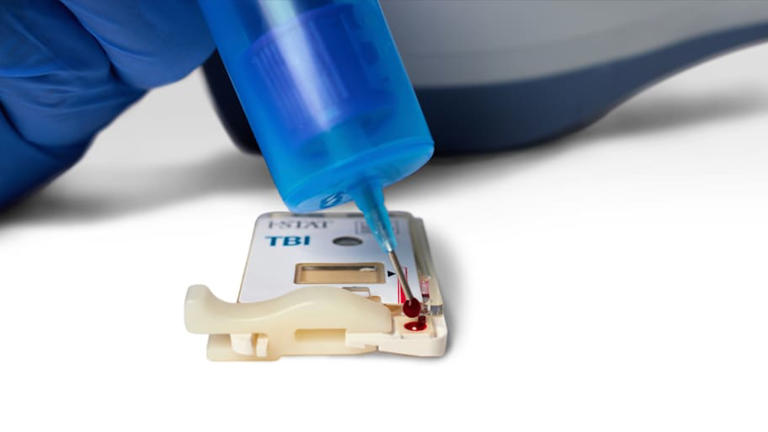 i-STAT TBI Blood Test: The 15-Minute Revolutionary Concussion Test