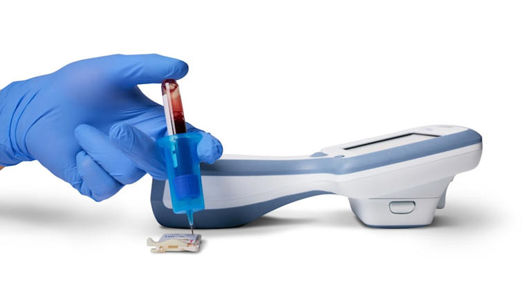 i-STAT TBI Blood Test: The 15-Minute Revolutionary Concussion Test
