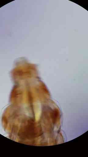 Magnified Water Bear Under Microscope | 400X Zoom | Science Discovery