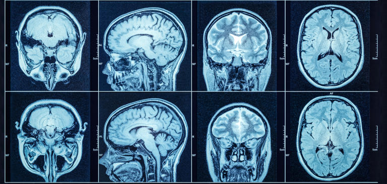 CDC issues urgent alert as brain-bleeding virus cases surge more than ...