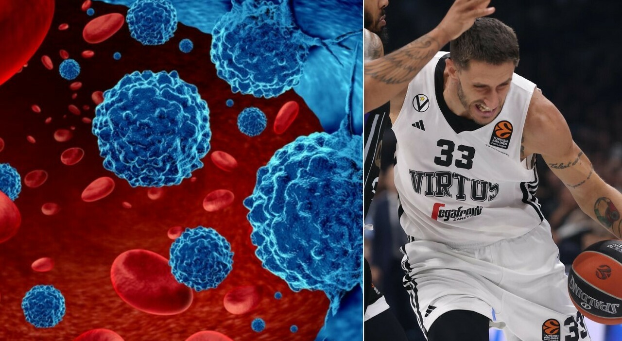 Leucemia mieloide, cos'è la malattia di cui soffre Achille Polonara ...