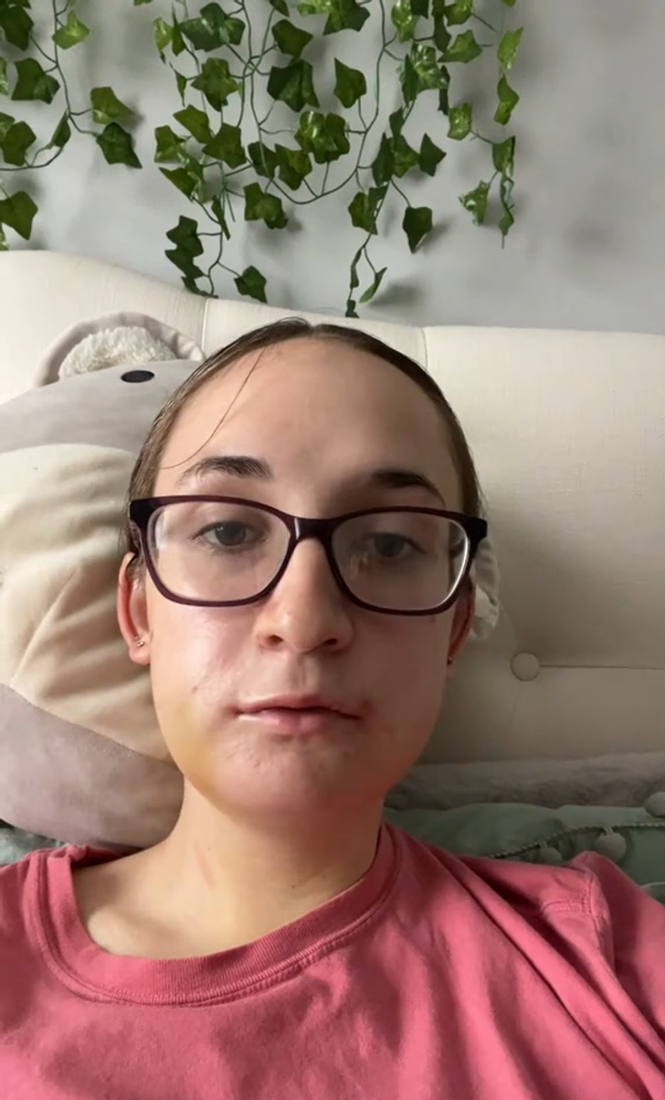 Young Woman Reveals Stunning Jaw Surgery Results That Leave People ...