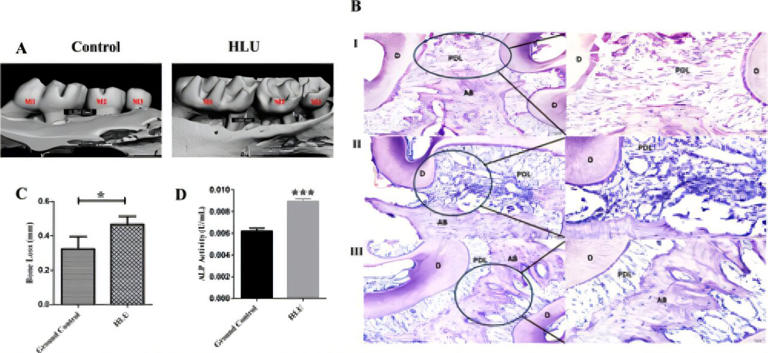 Space conditions can cause gum inflammation and bone loss, say scientists