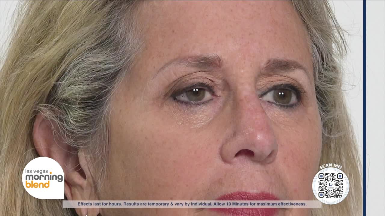 Plexaderm Helps Reduce Signs of Aging