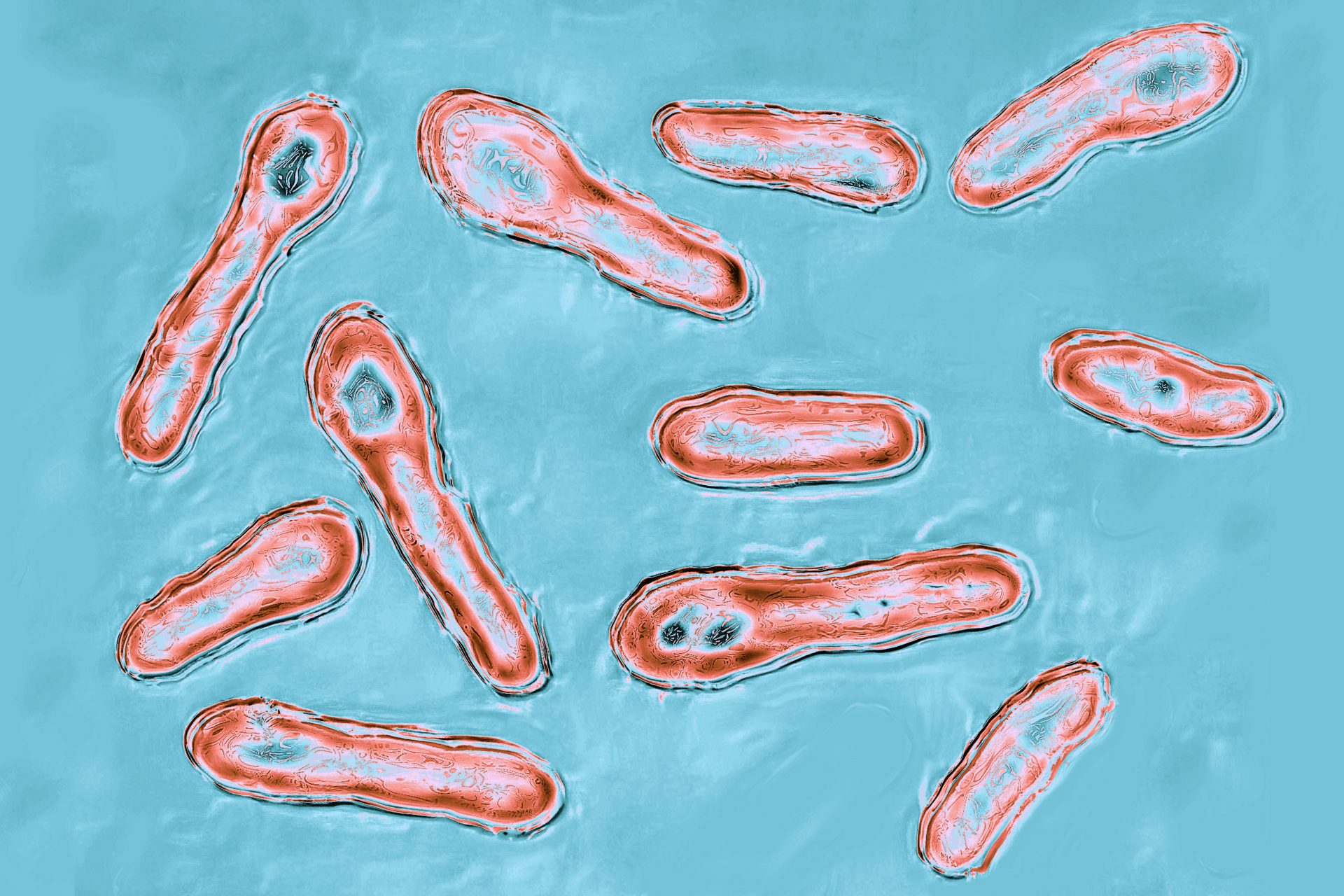 Botox: all you need to know about the 'miracle poison' for your face