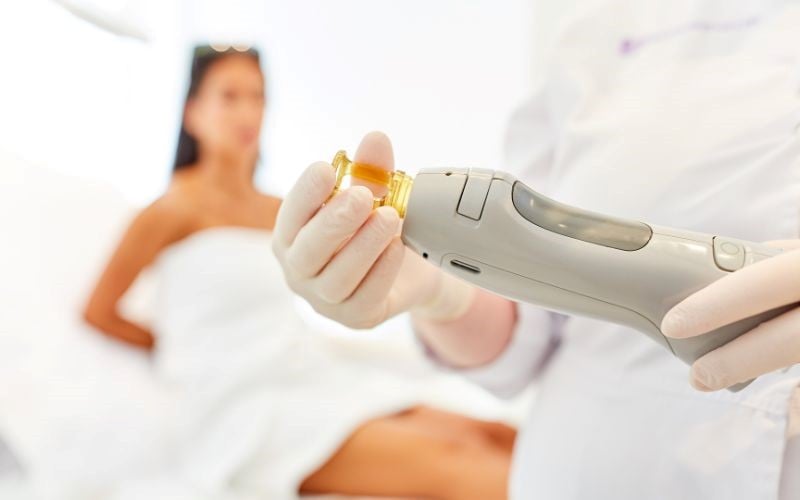 Μύθοι & αλήθειες για την αποτρίχωση με laser