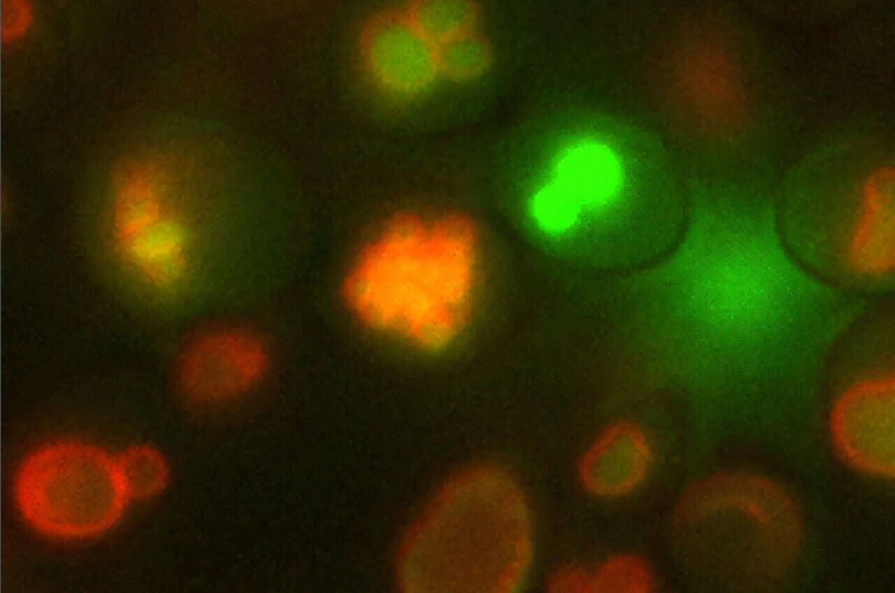 Genetically modified yeast can create valuable materials from urine