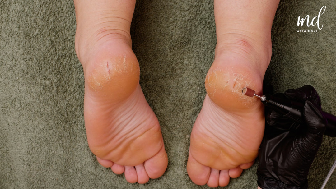 Healthy Feet Need a Pedicure