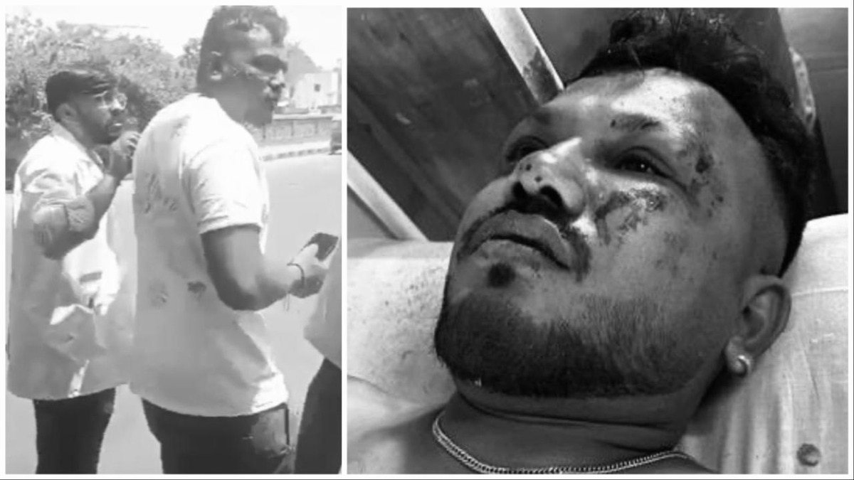 Air India crash survivor released from hospital, to perform brother's ...