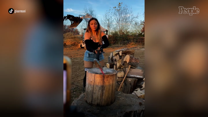 After Surviving Vicious Dog Attack, Model Finds Strength and a New Life ...