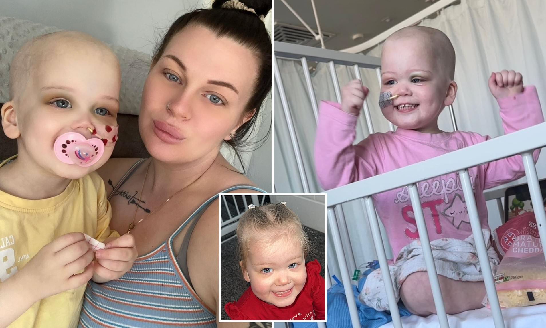 My tot had a fall while playing and woke up with completely BLACK eyes ...