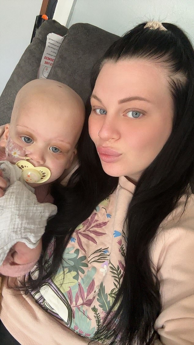 My tot had a fall while playing and woke up with completely BLACK eyes ...