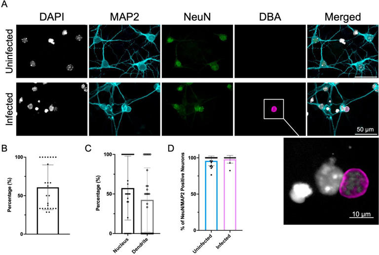 How a common brain parasite disrupts neural communication