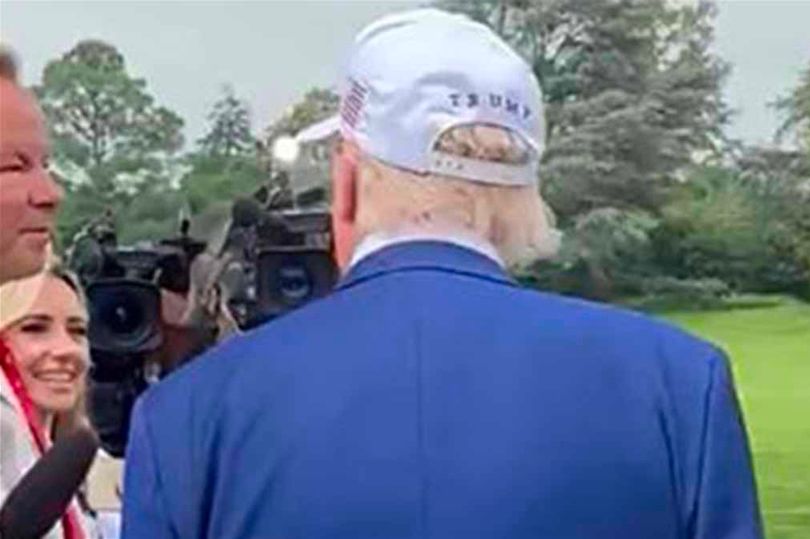 Trump's strange neck marks beneath ruffled hair spark further health ...