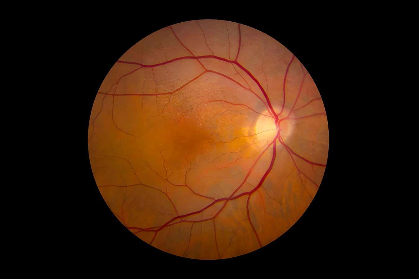Retinal implant restores sight for blind mice