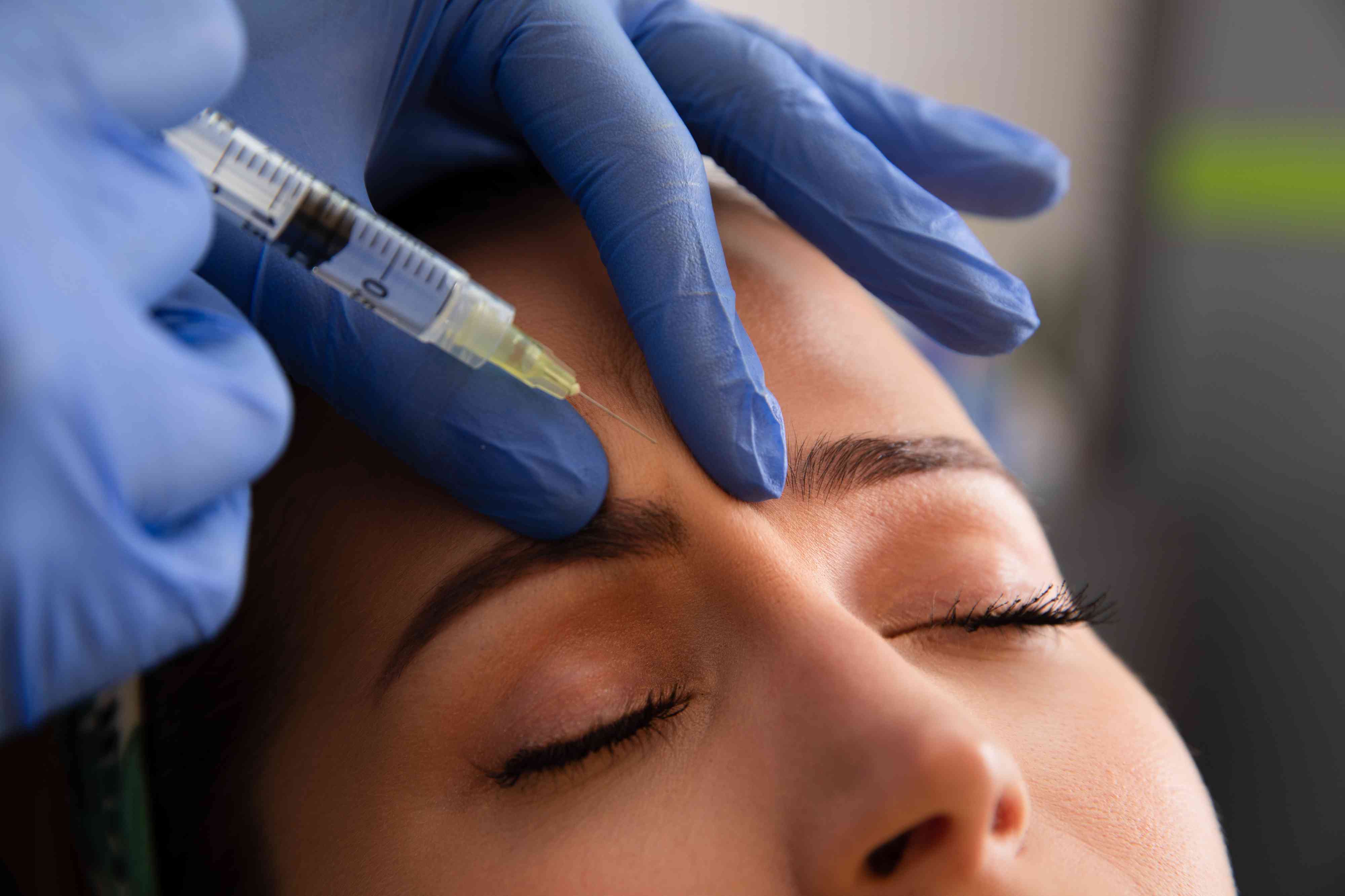 7 side effects of Botox to know before getting injections