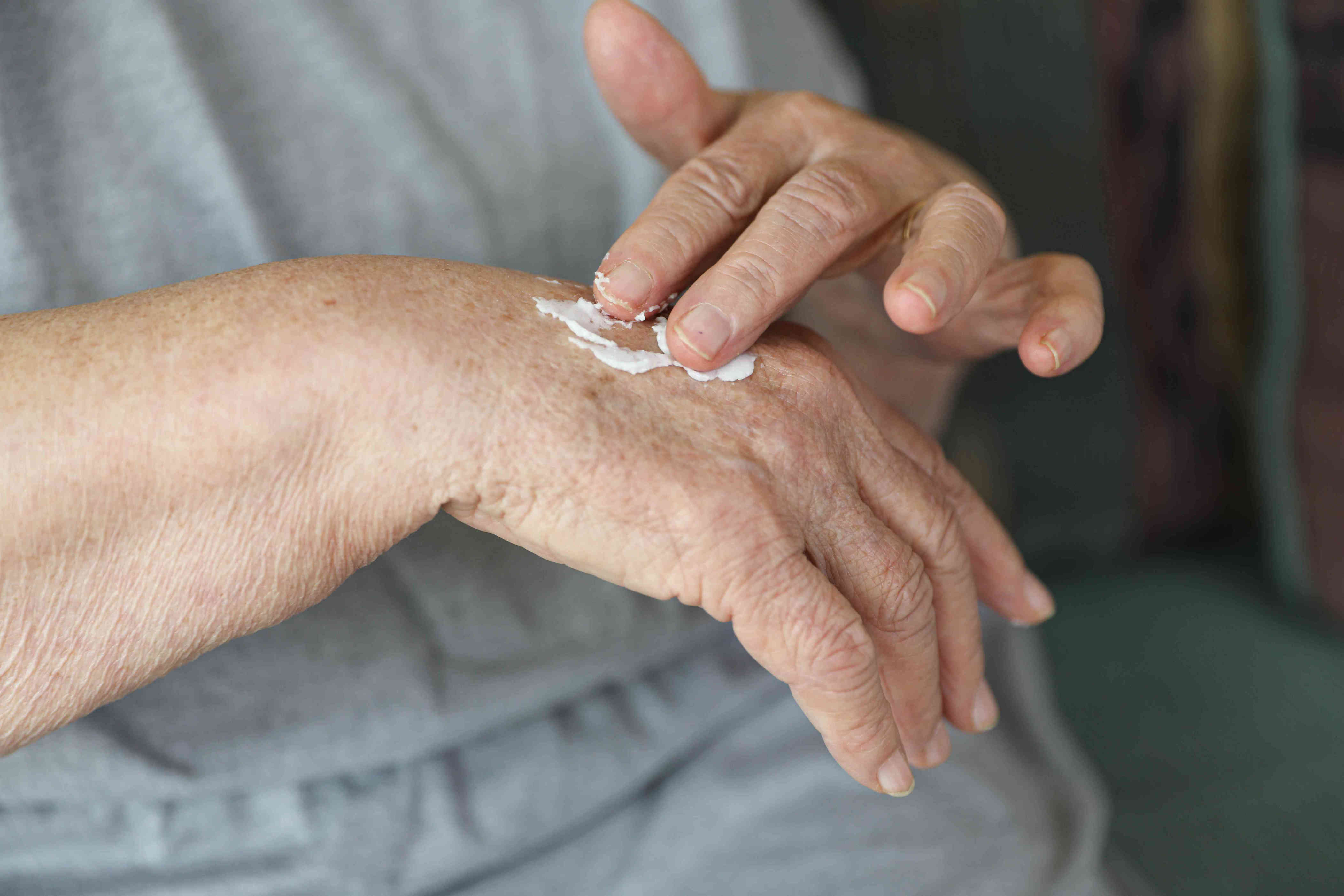 Why Your Skin Feels Dry, Even After Moisturizing: Tips for Ultimate ...