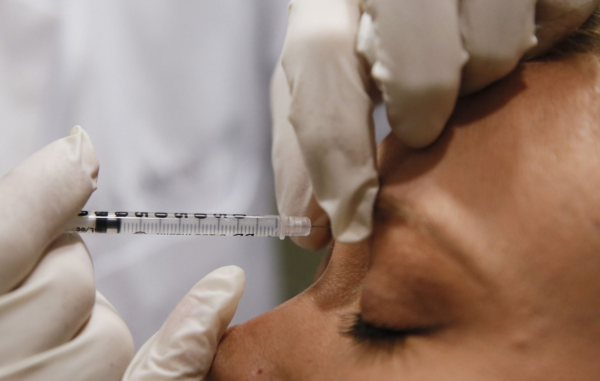 Botulism cases linked to Botox used on the South Shore, DPH says