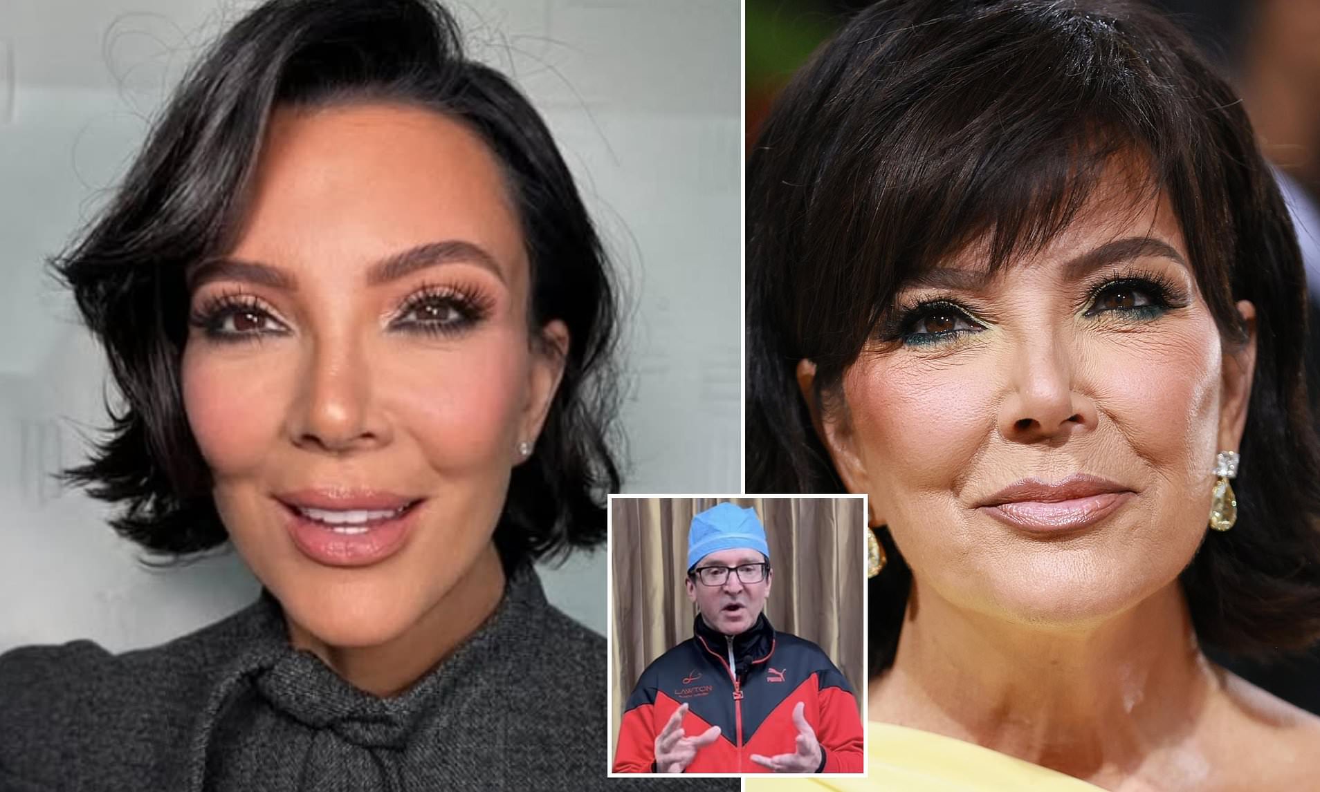 Kris Jenner's facelift is 'AI trickery' says top surgeon: 'Pictures ...