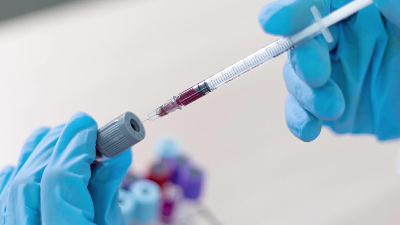 New FDA-approved Alzheimer’s blood test coming to Mayo Clinic