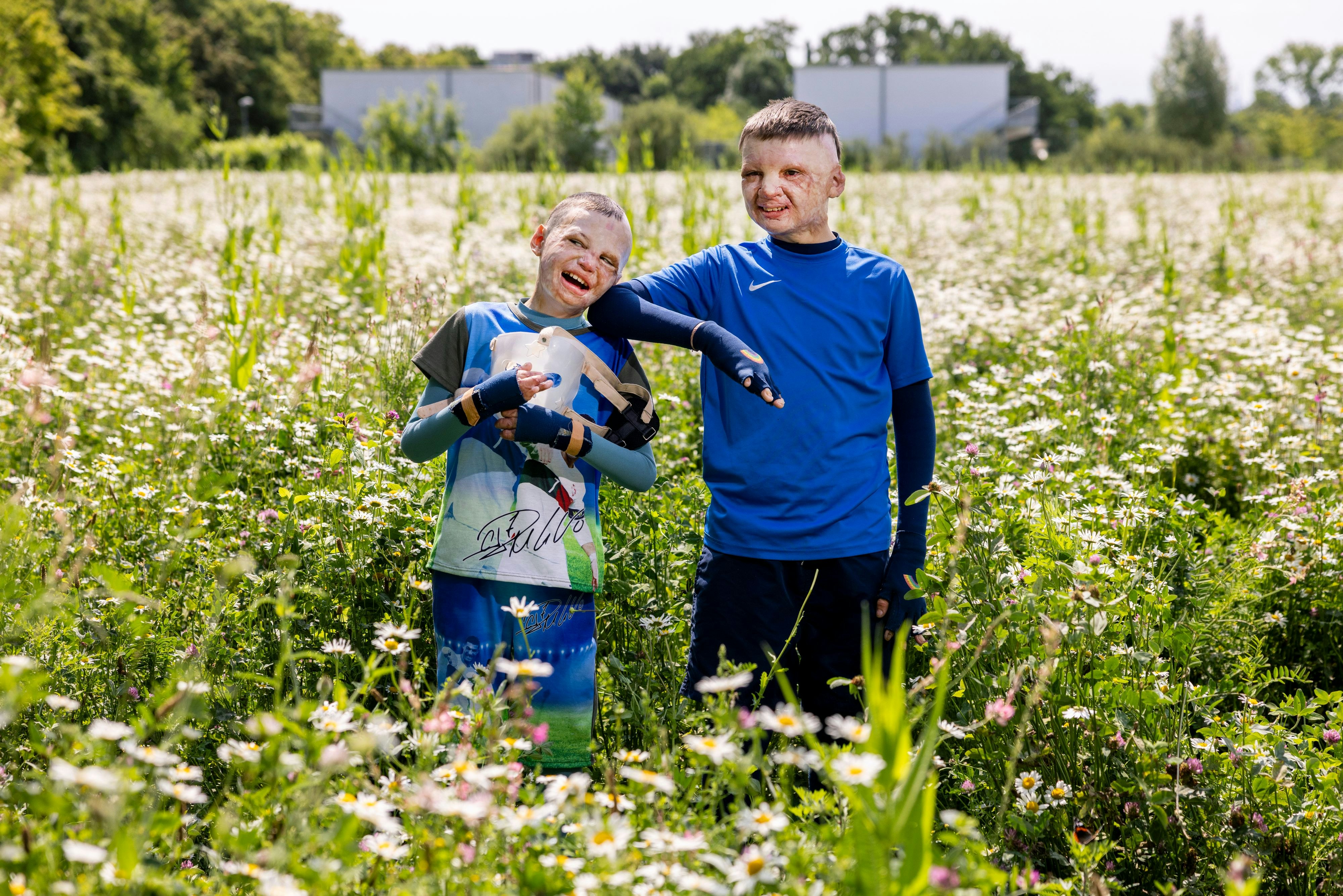 Ukrainische Kinder: Yurii und Yevhen überlebten trotz schwerster ...