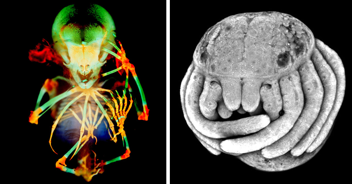 32 Embryos That Look Suspiciously Like Baby Aliens