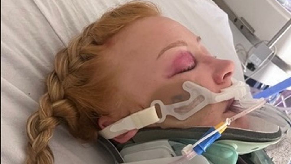 Victim of Dauphin County hit-and-run seeks justice, urges driver ...