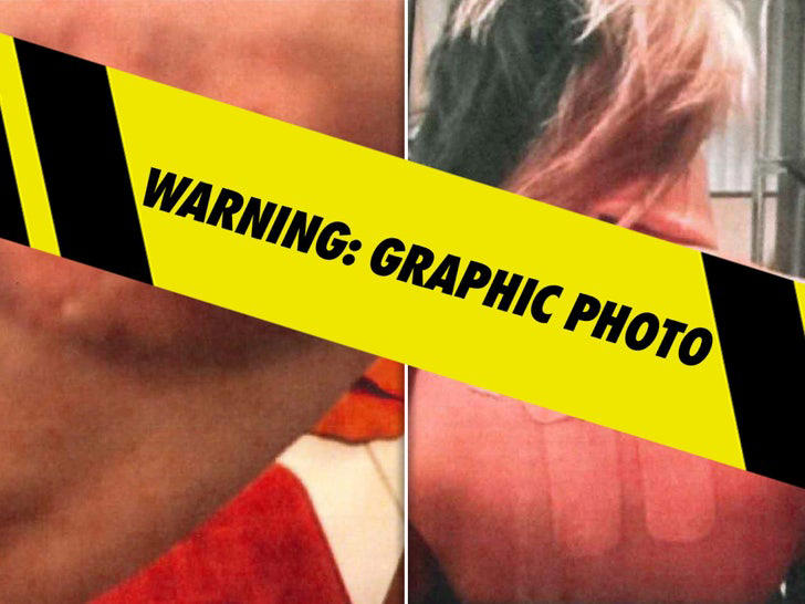 Bryana Bongolan's Alleged Injury Photos From Diddy Balcony Incident Filed As Evidence