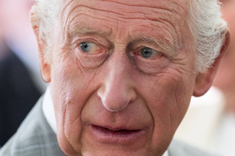 King Charles III's cancer deemed manageable, not curable: new health ...