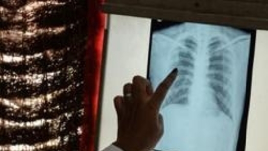 Human cost of poor-quality testing in India