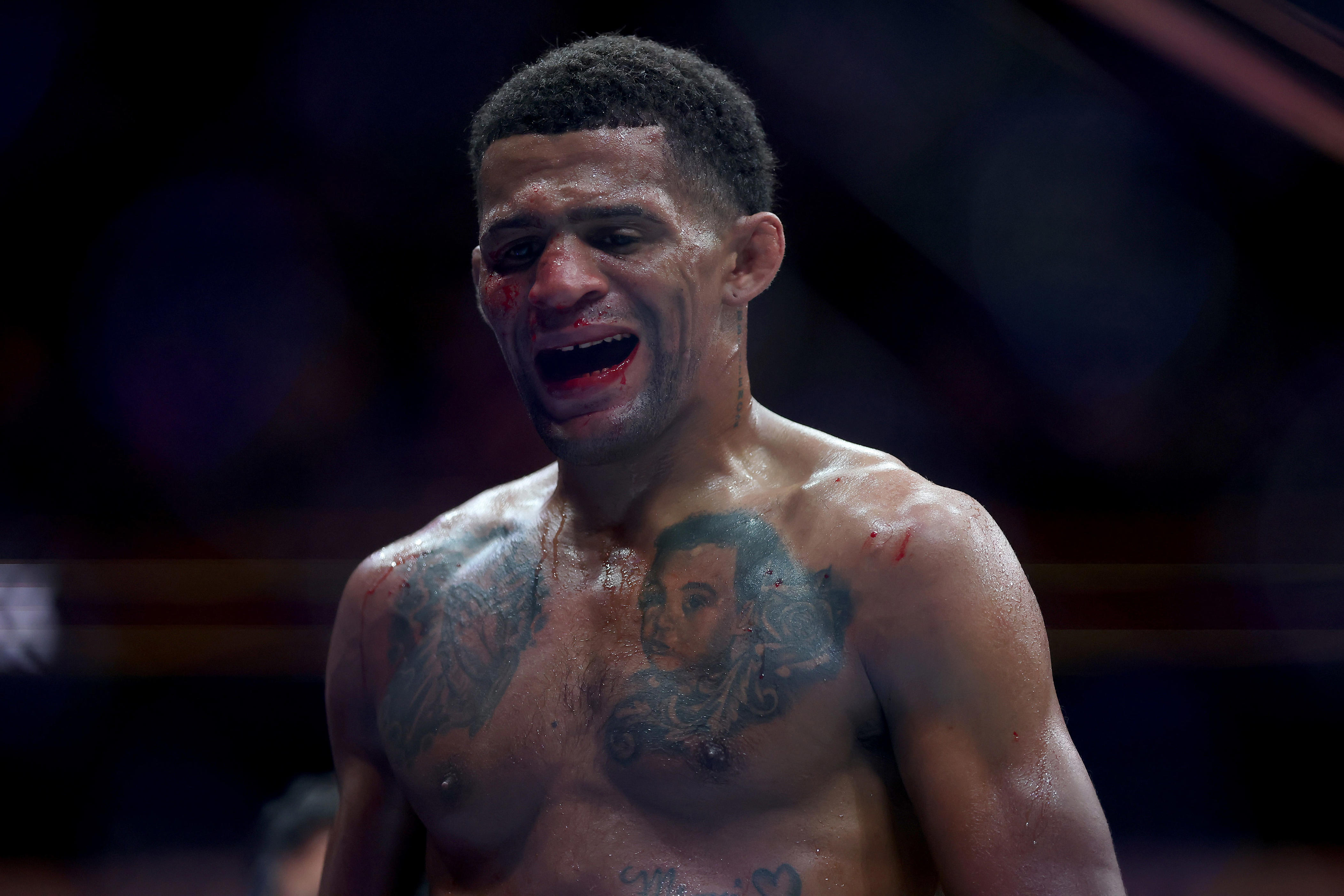 Patchy Mix predicts rebound after upset loss to Mario Bautista in debut ...