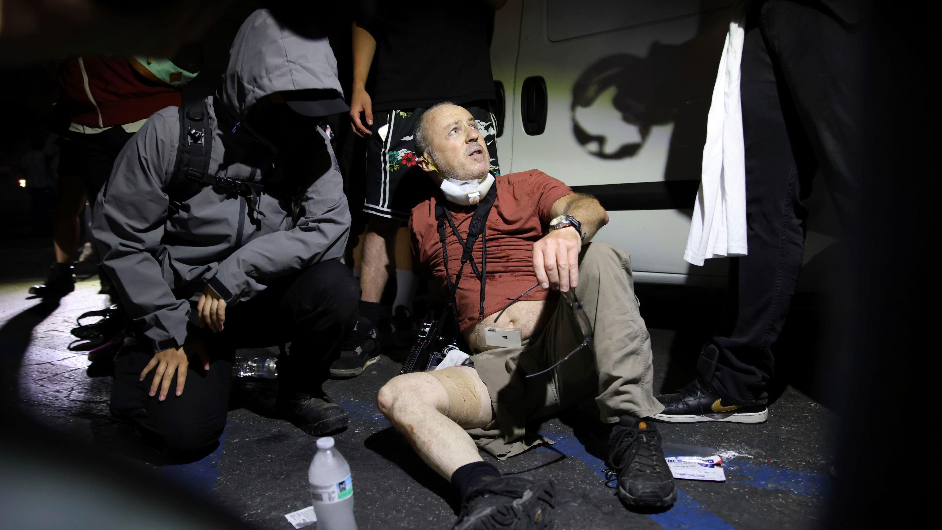 British photographer hit by non-lethal bullet in LA