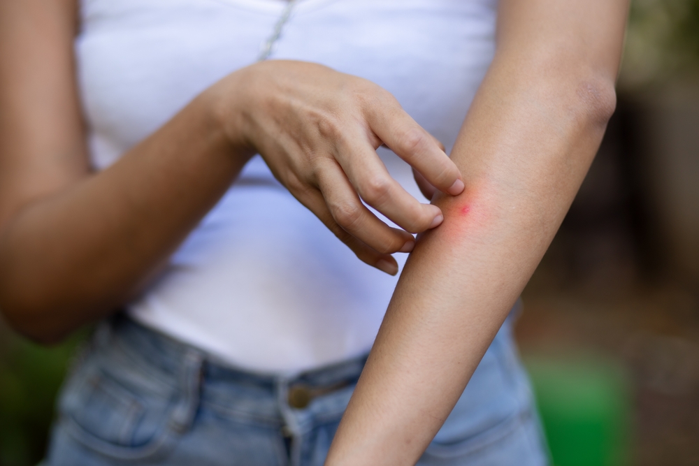 Pay Attention to These Symptoms If You’ve Been Bitten By a Spider