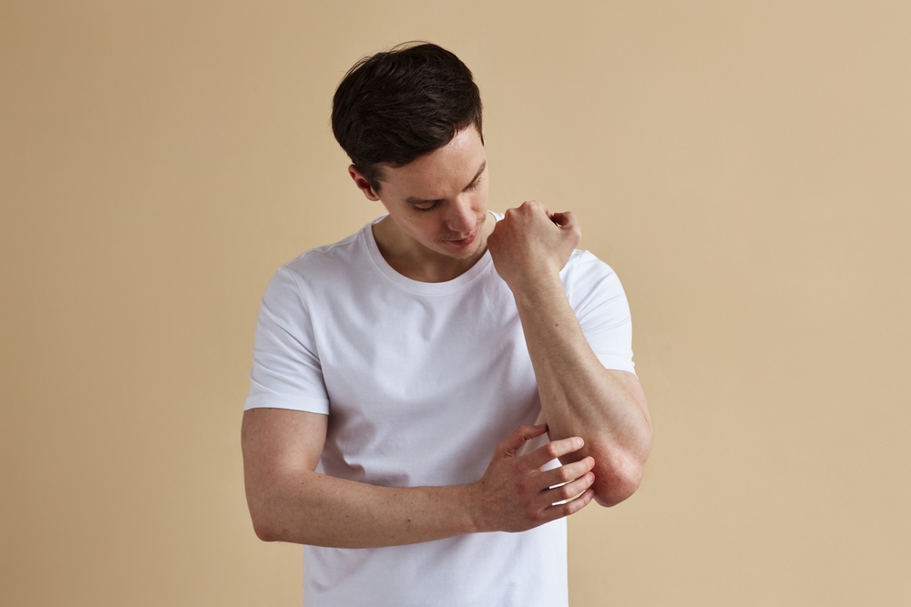What Those Tiny Bumps on Your Arms Really Mean – And How to Get Rid of Them