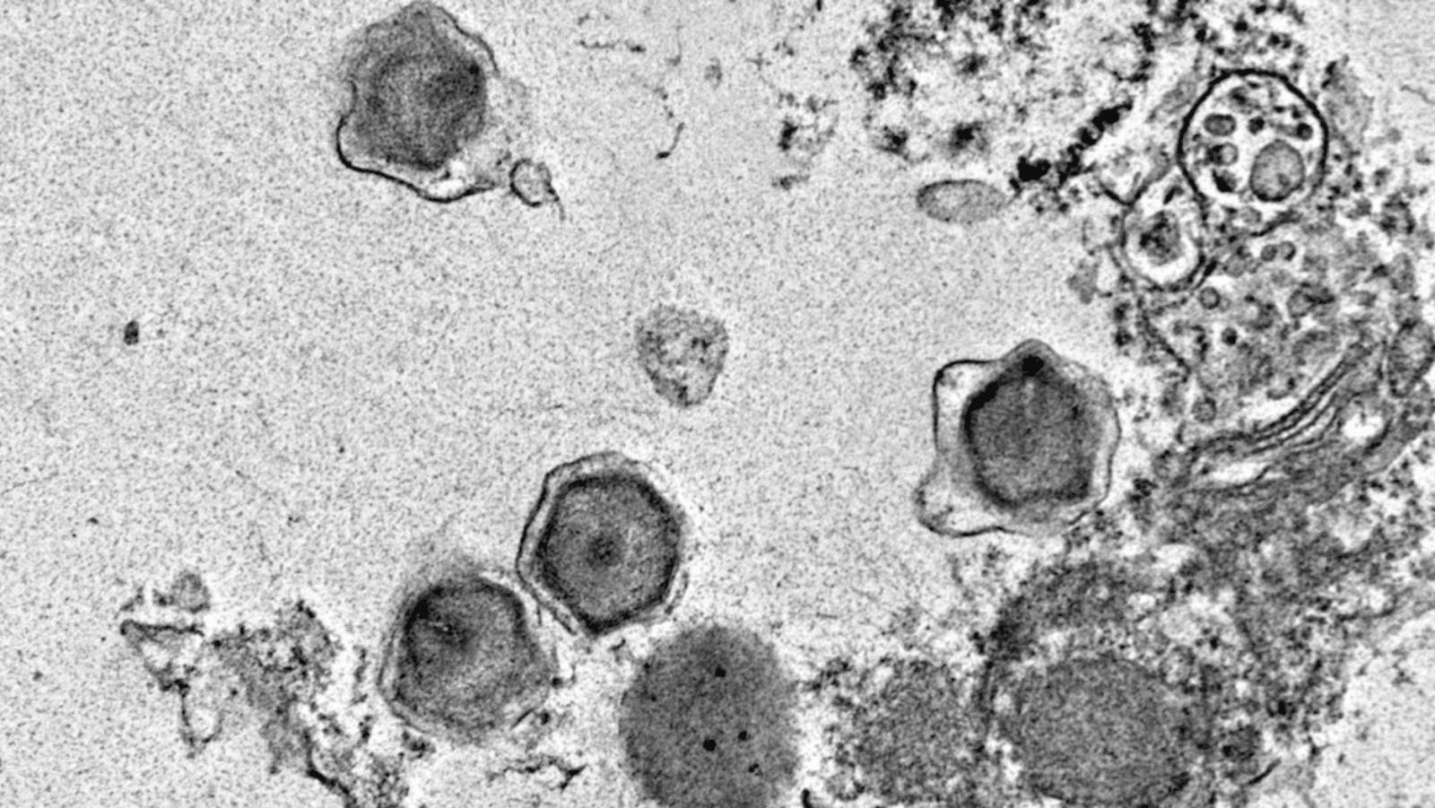 Scientists discover 230 new giant viruses hidden in the world’s oceans