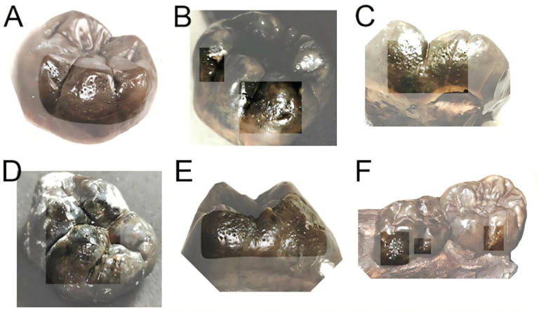 Two-million-year-old pitted teeth from our ancient relatives reveal ...