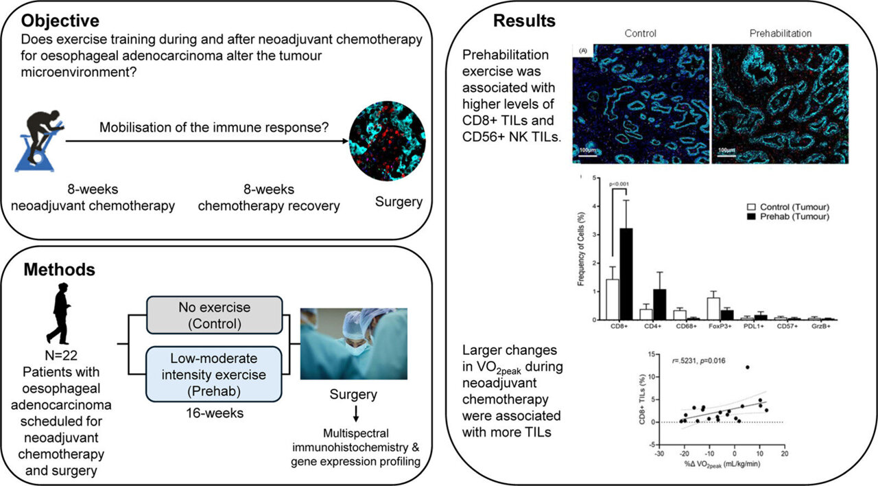 Exercise during chemotherapy may help immune cells fight cancer