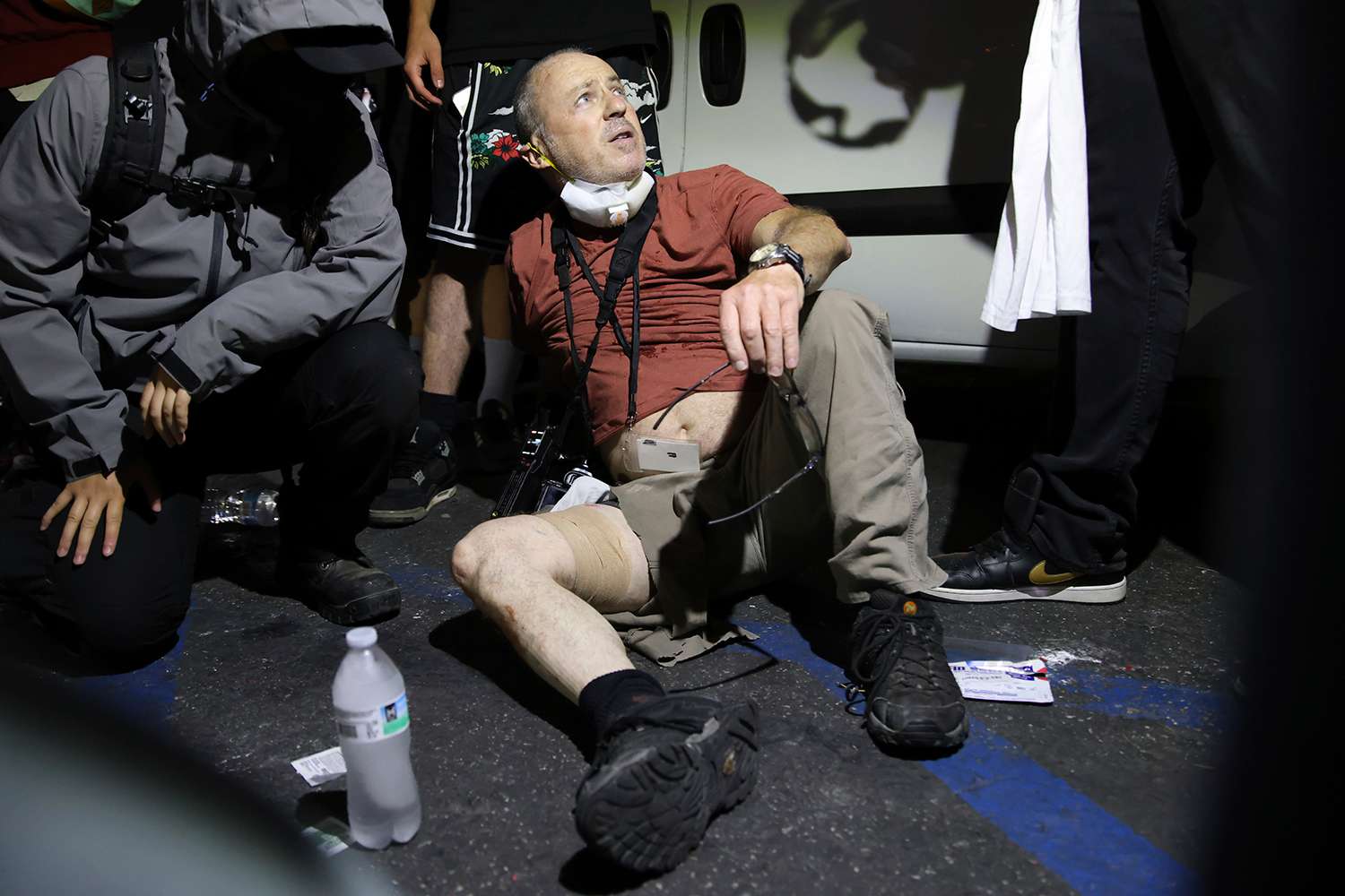 Journalist Shot with Explosive Device While Wearing Press Badge at L.A ...