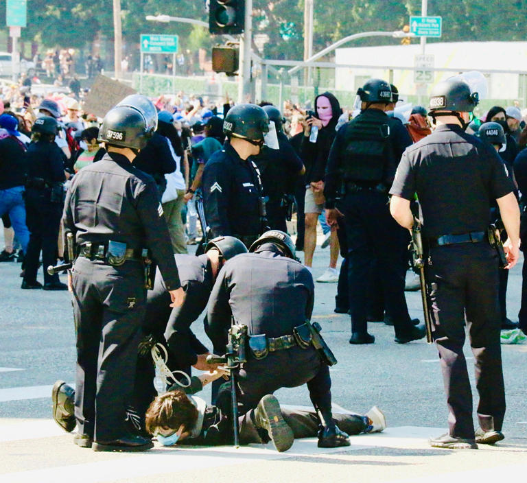 KNX News reporter recounts being shot by rubber bullet during L.A. protest