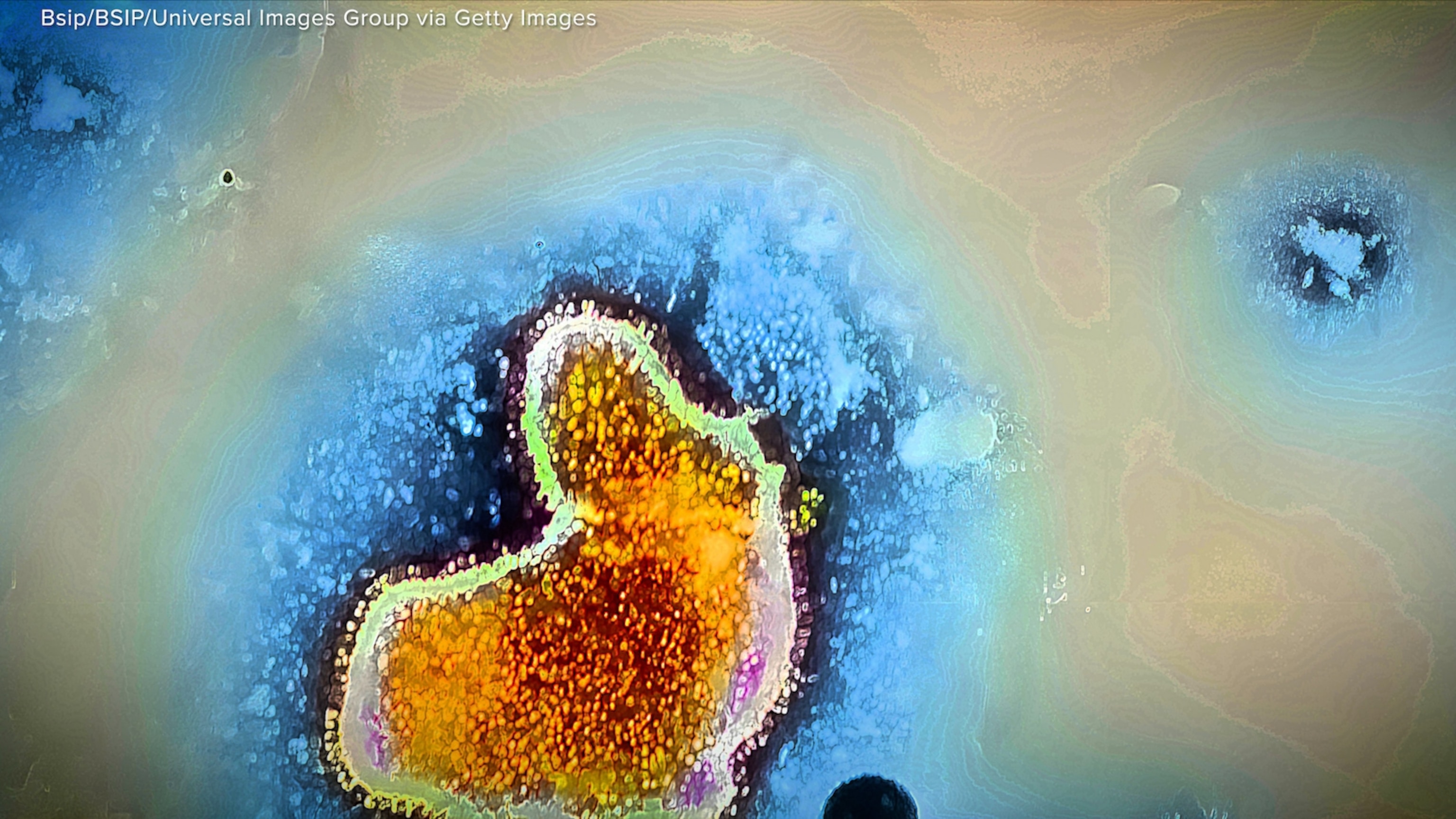 What to know about rare, brain-eating amoeba Naegleria fowleri