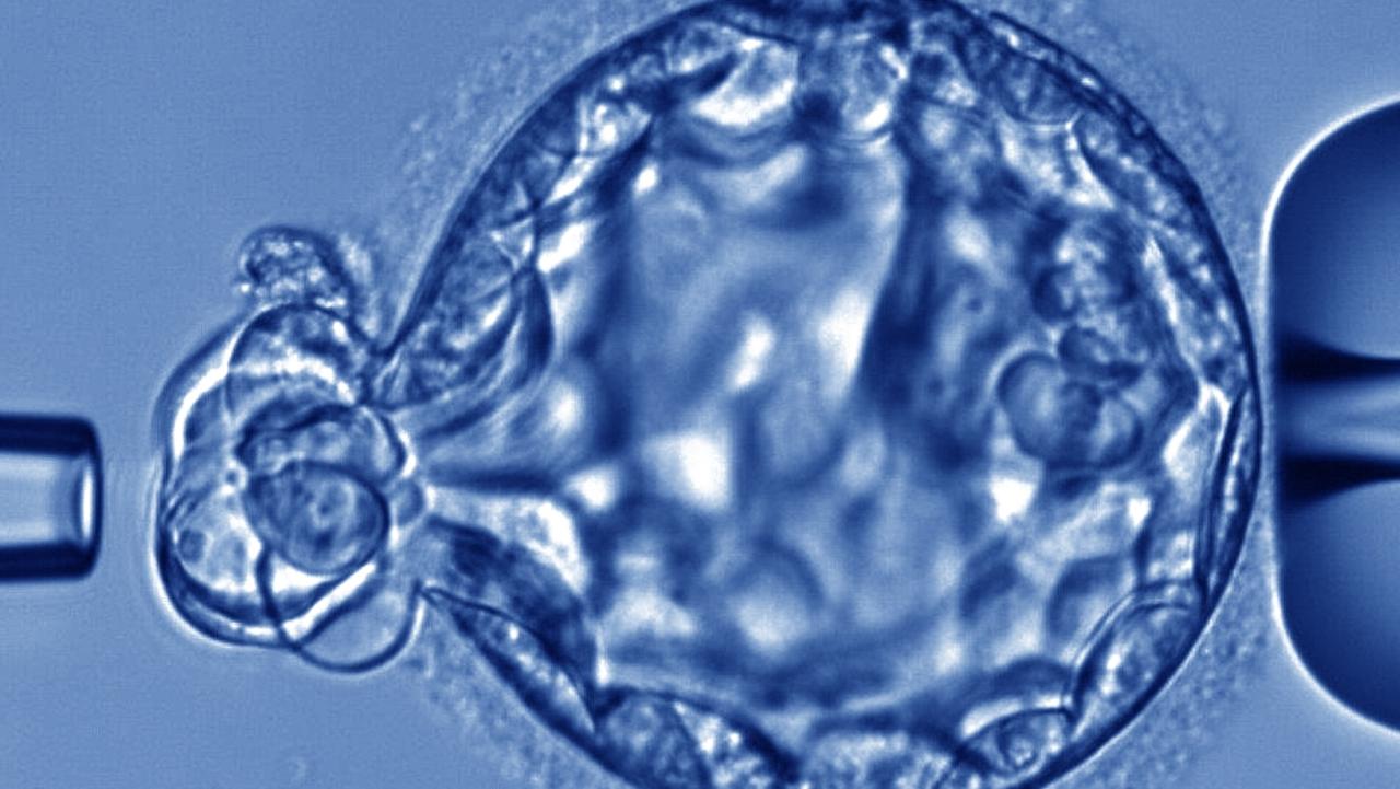 CEO resigns after second Monash IVF bungle