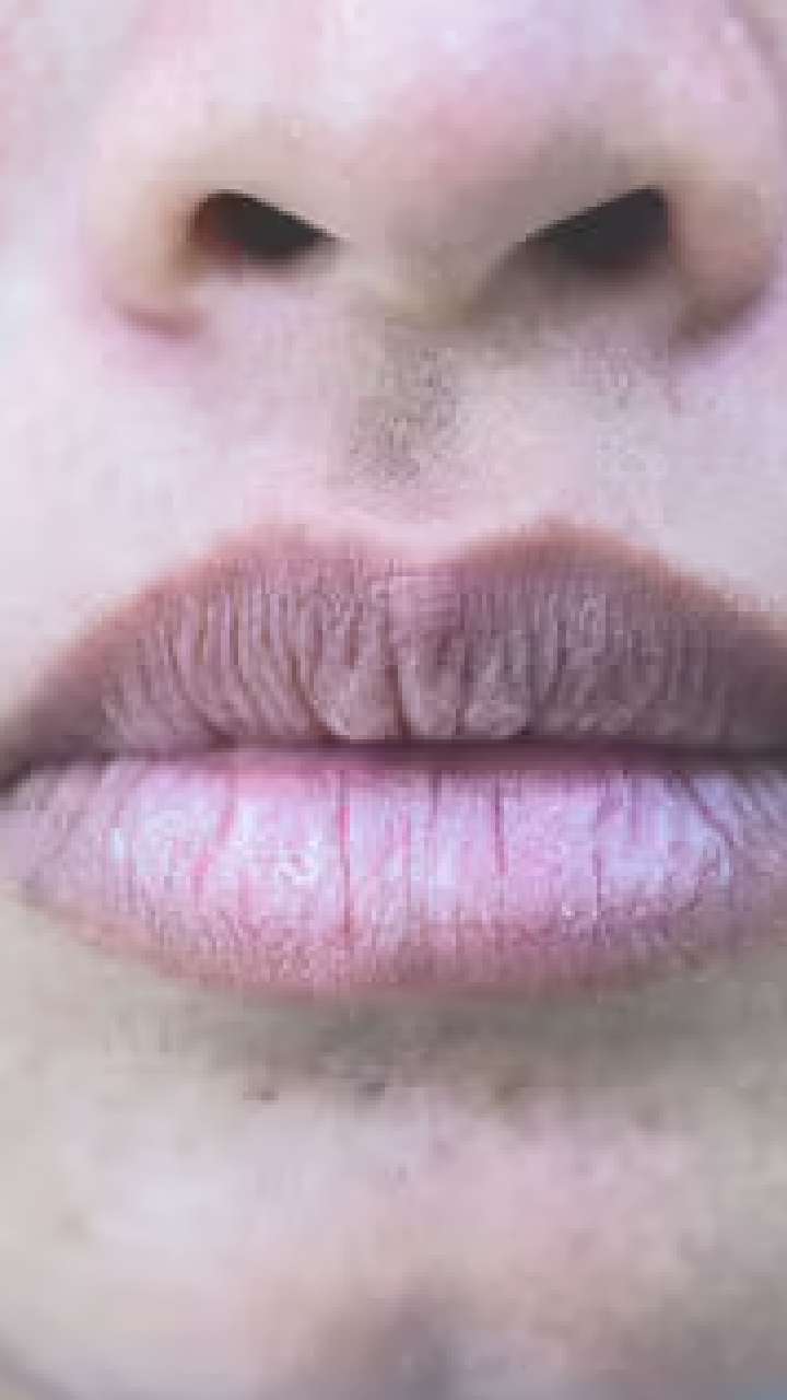 What Does Your Lip Colour Indicate About Your Health?