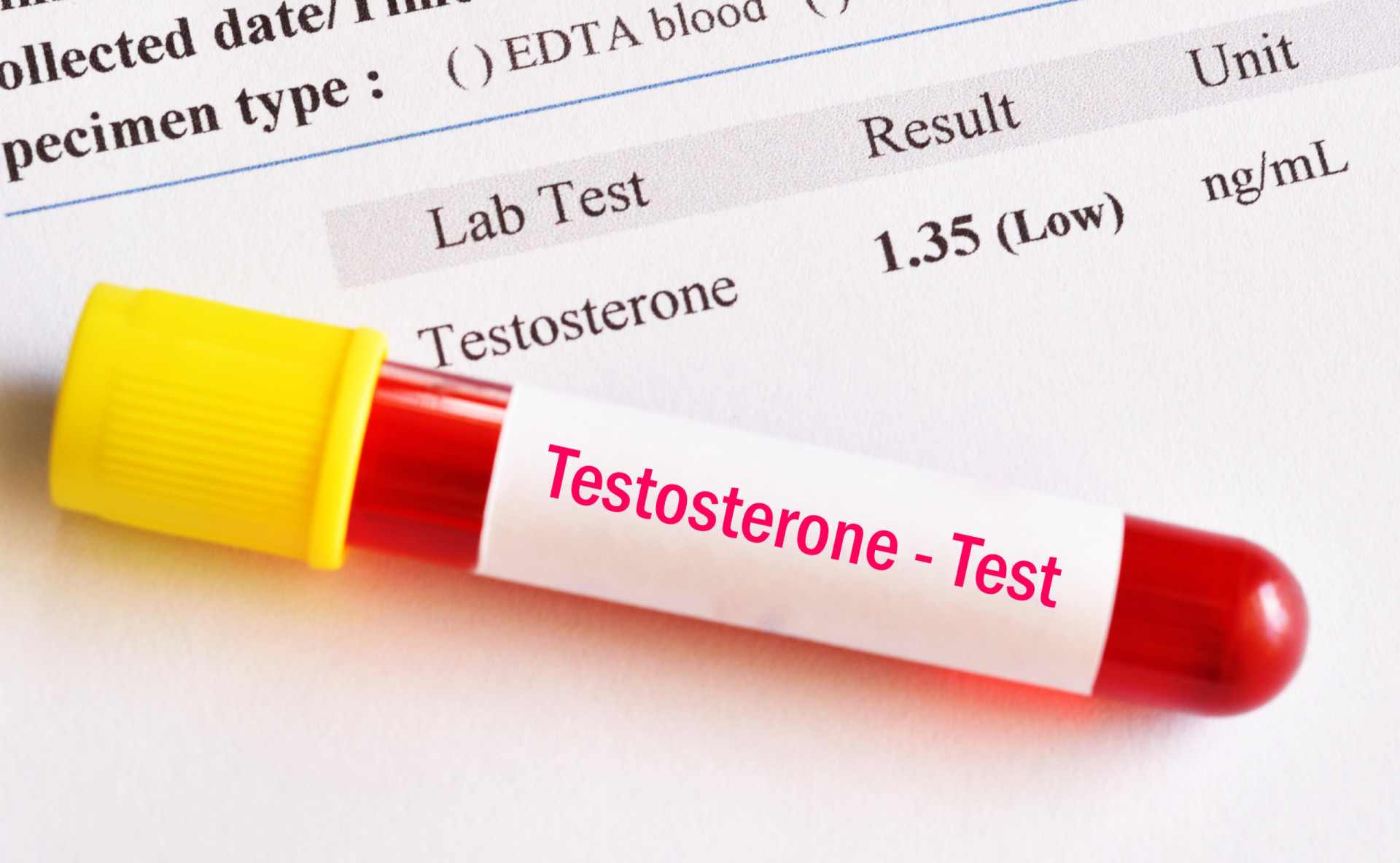 Bassi livelli di testosterone, ecco i sintomi da non sottovalutare mai ...