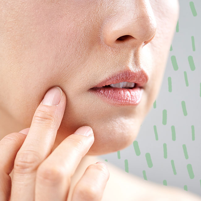 Want To Smooth Out Deep Smiles Lines Without Surgery? An Esthetician ...