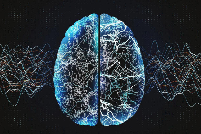 Epilepsy More Common With Frontotemporal Dementia