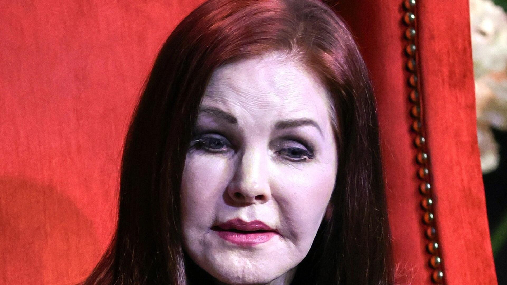 Insane Celebrity Plastic Surgery Before & Afters