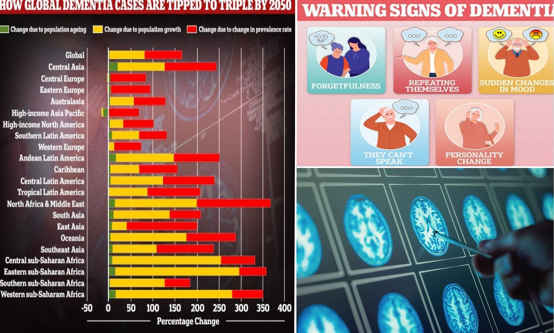 Top scientists flag little-known earliest signs of dementia that have ...