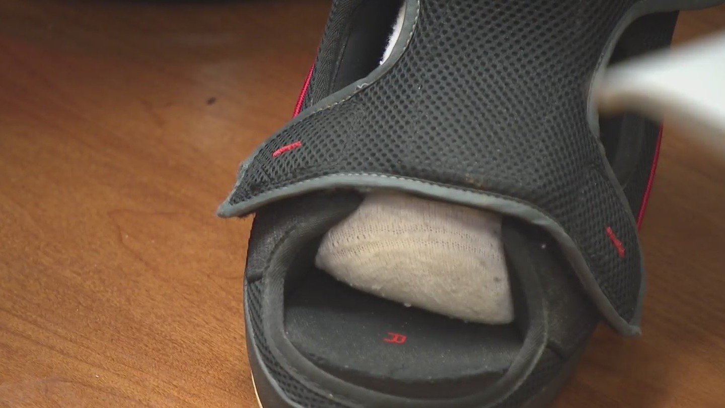 New Pitt study detects invisible diabetic wounds