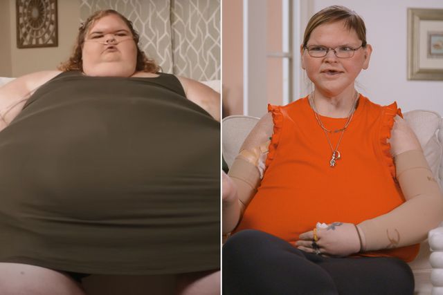 “1000-Lb. Sisters”’ Tammy Slaton Faces Her Fears, Gets Skin Removal ...