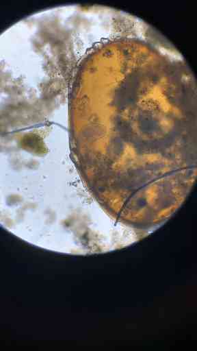 This Microscopic Creature is ALIVE